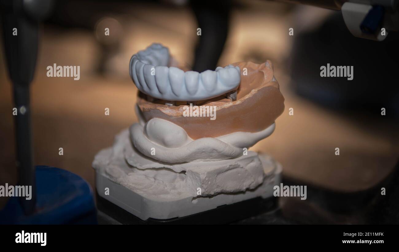 Plaster model of teeth, model of teeth, works of a dental technician ...