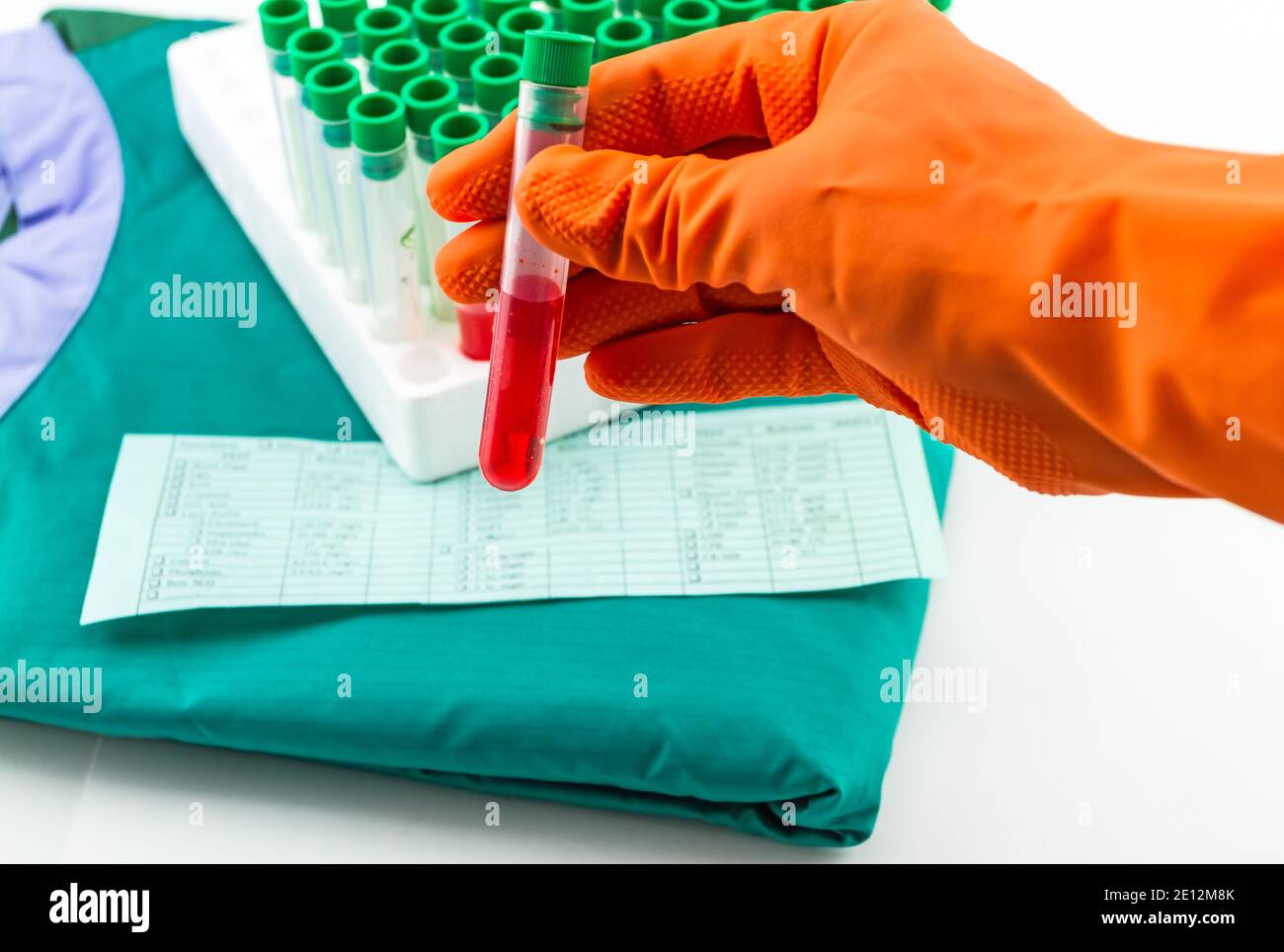 Hand with latex glove holding blood sample vial in front of blood test ...