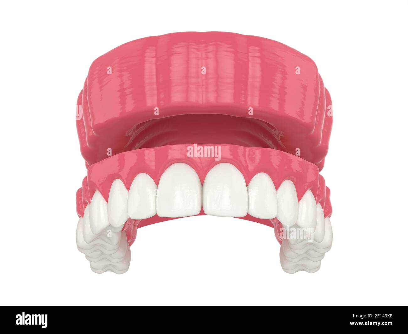 3d render of removable traditional denture installation over white ...