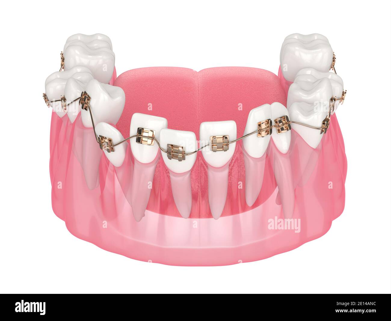 Abnormalities of teeth hi-res stock photography and images - Alamy