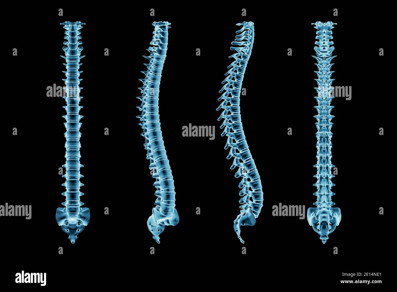 X-Ray human spinal column or backbone or spine from various angles ...