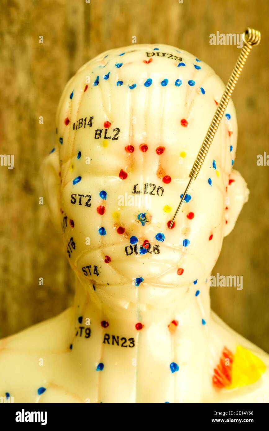 Acupuncture Demonstration On Head Model Stock Photo - Alamy