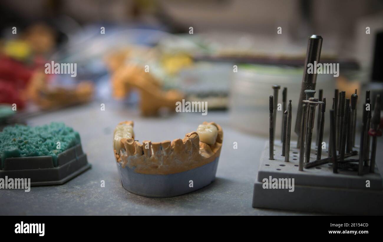 Tools for dental prosthetics., plaster model of ceramic teeth, dental ...