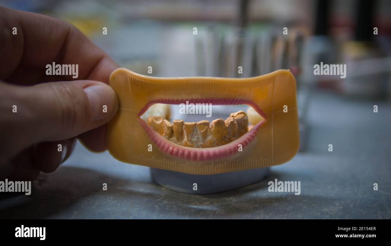 Plaster model of teeth, the work of a dental technician, tools for ...