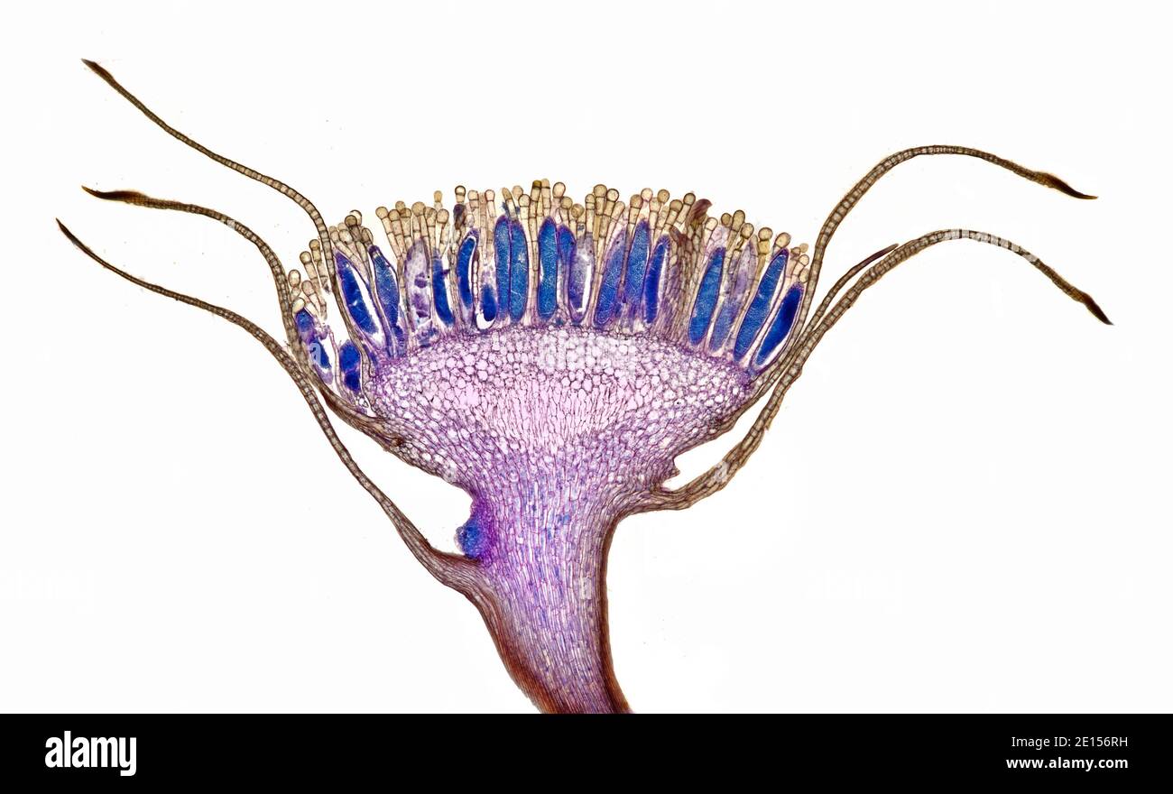 Funaria, male plant LS.brightfield photomicrograph Stock Photo - Alamy