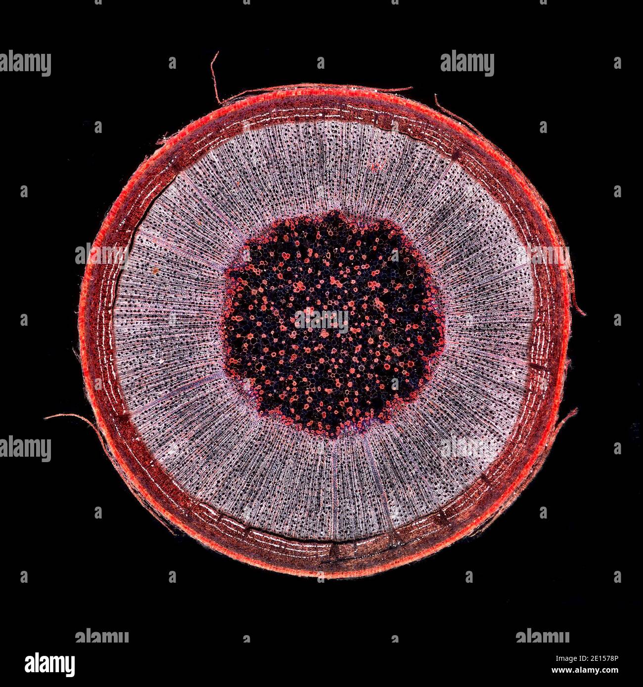 Photosynthesis osmosis xylem sap phloem darkfield photomicrograph hi ...