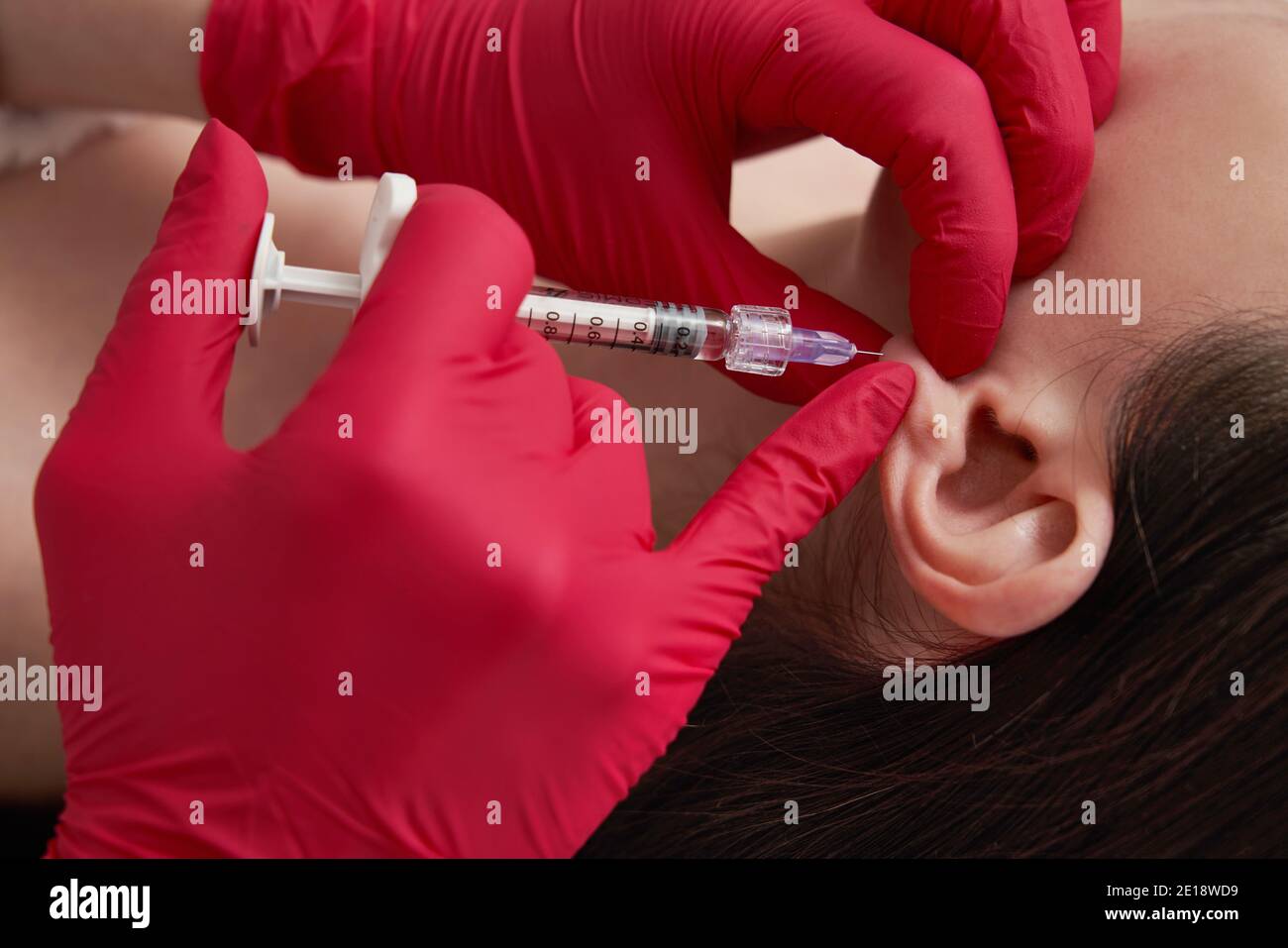Cosmetologist doctor makes the injections procedure in ear for ...