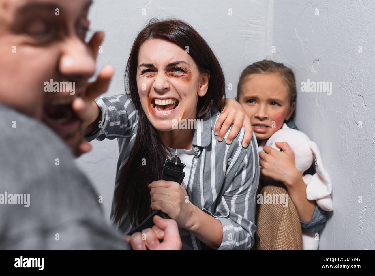 Bruised Face From Slap