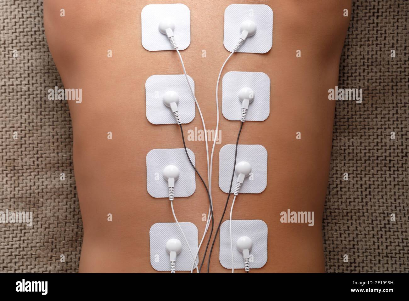 Electrode Stimulating massage of the spine at home. Medical procedure ...