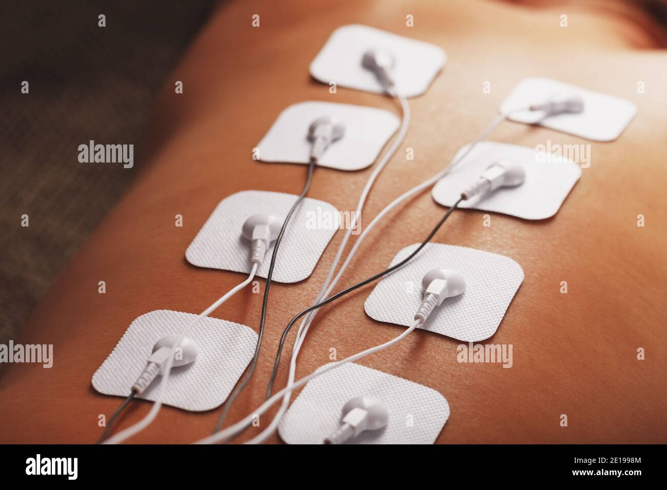 Electrode Stimulating massage of the spine at home. Medical procedure ...