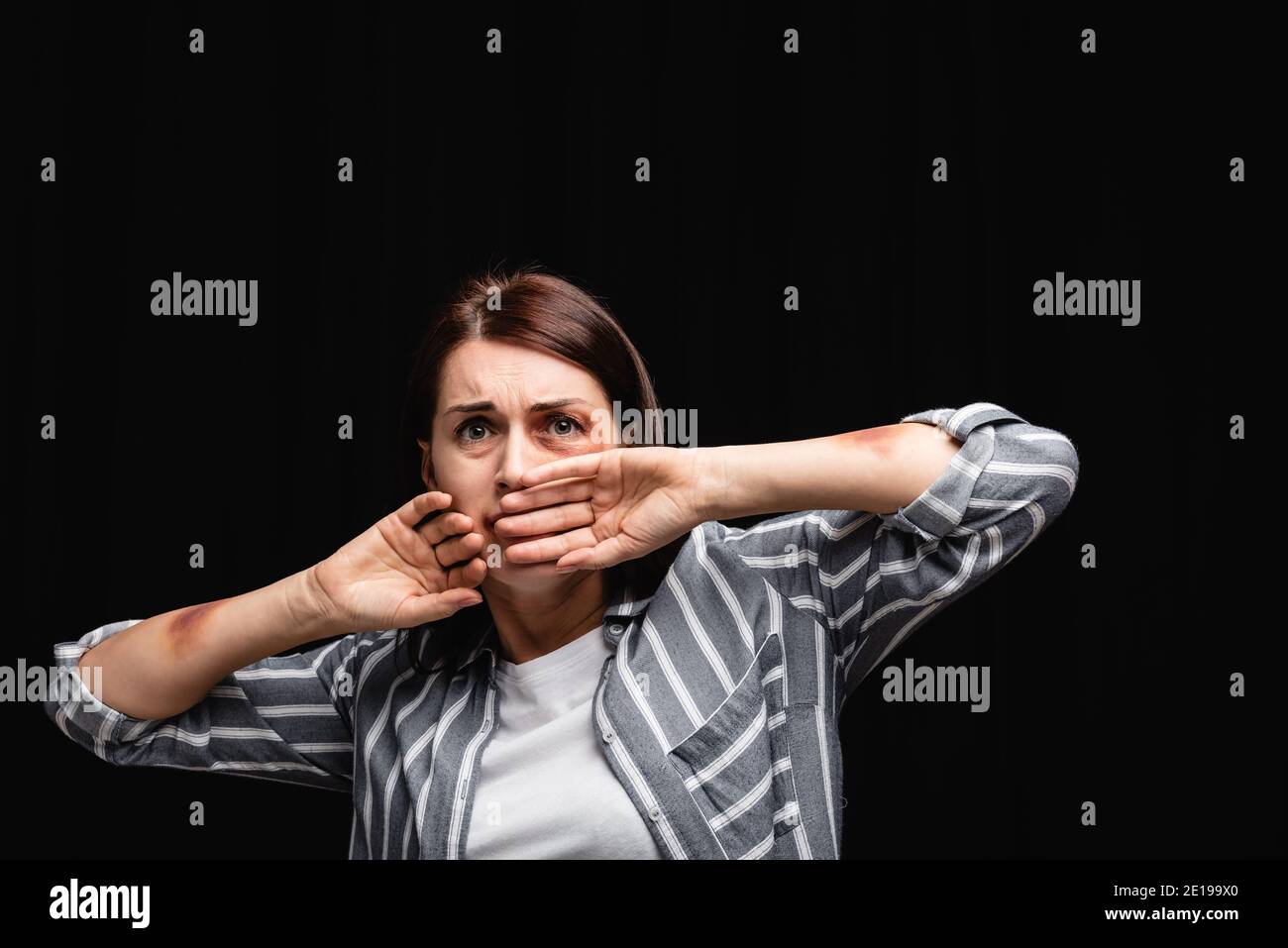 Scared woman with bruises looking at camera isolated on black Stock ...