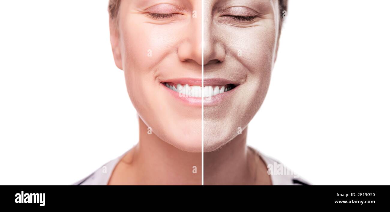 A woman's face is split in half for good and bad skin. Isolated on ...
