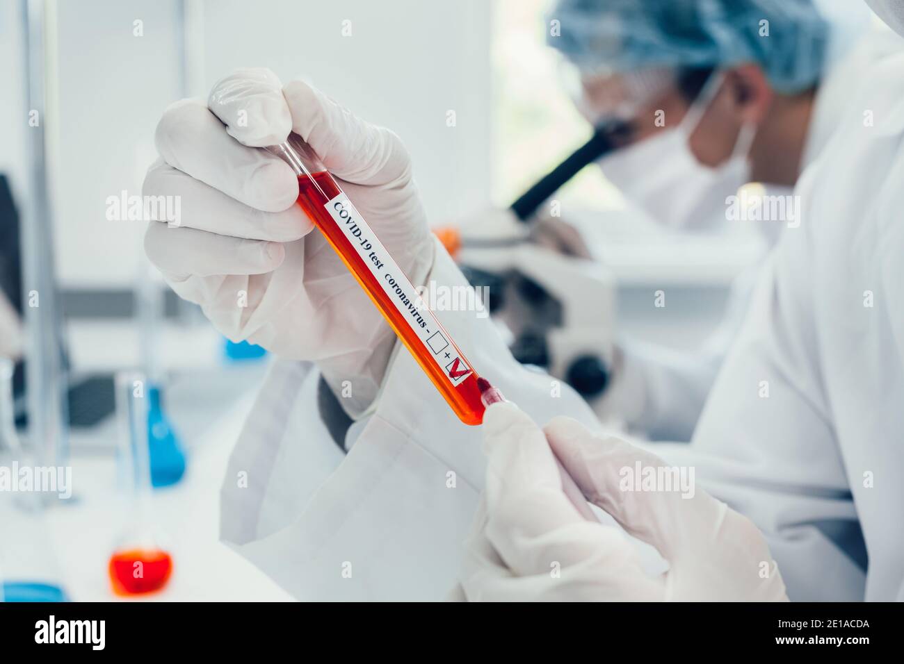 close up. lab technician making a mark on the tube with the test Stock ...