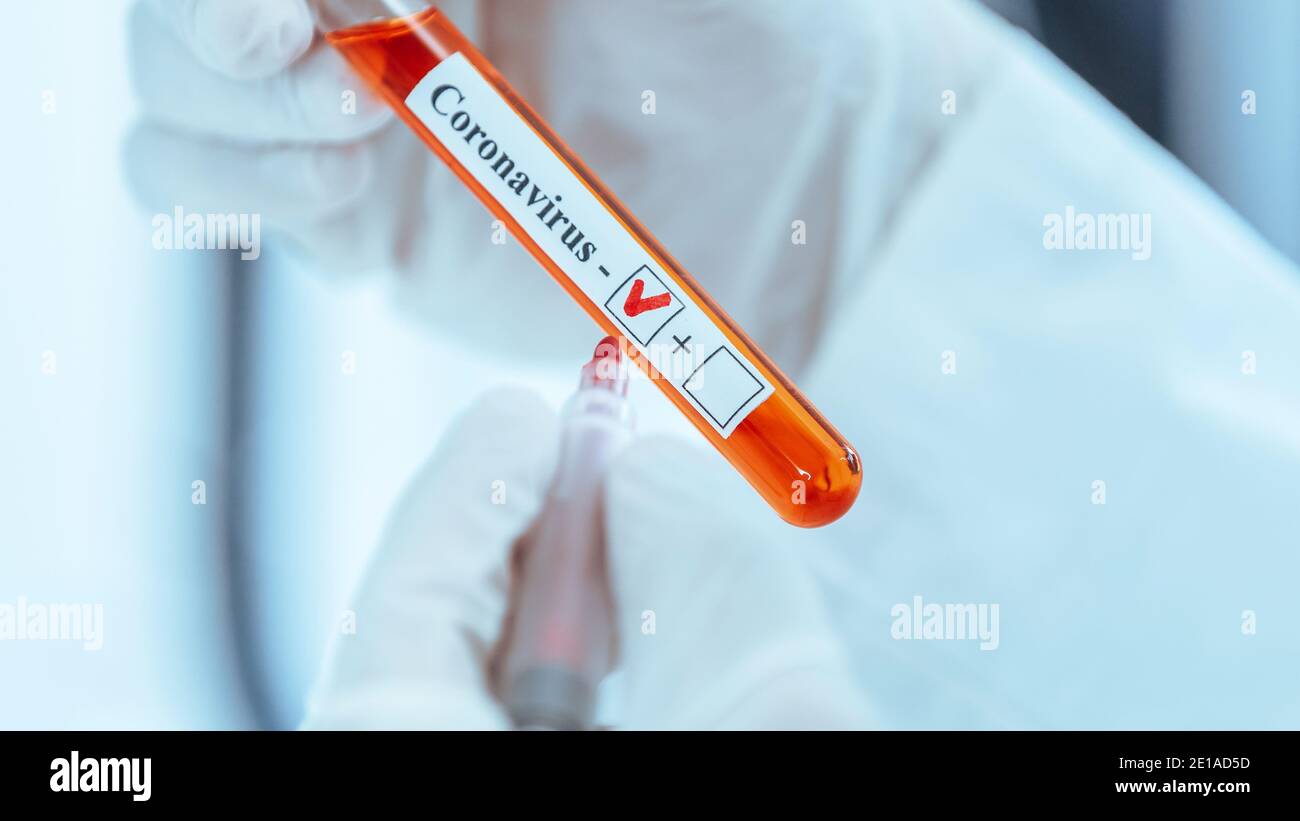close up. lab employee marking a verified test Stock Photo - Alamy