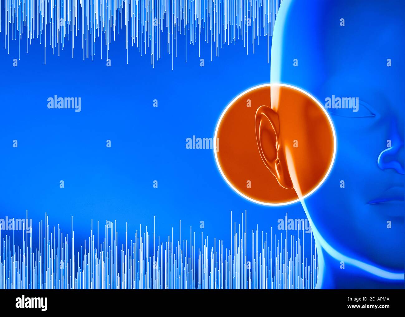 Hearing problems and solutions. Ultrasound. Deafness. Advancing age and ...