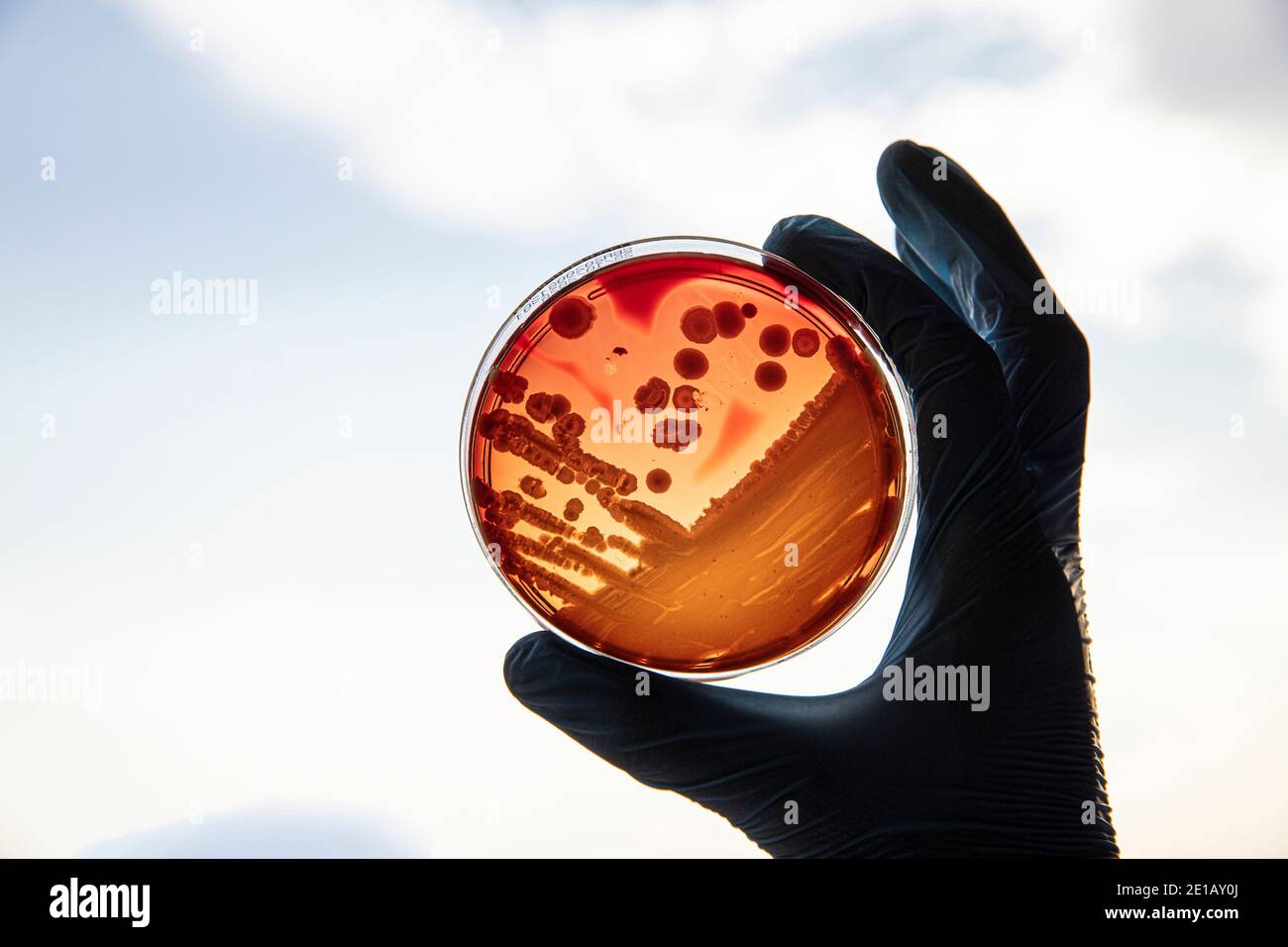 Growing bacteria in agar medium in microbiology lab. Making streak in a ...