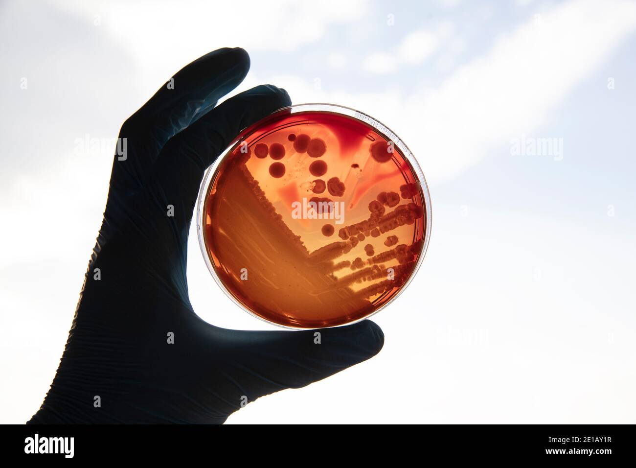 Growing bacteria in agar medium in microbiology lab. Making streak in a ...