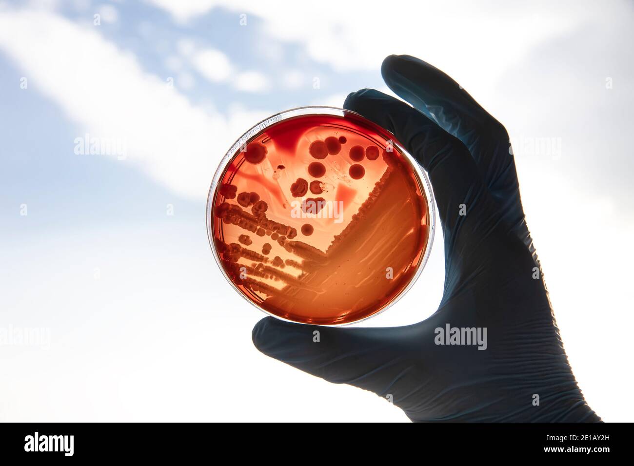 Growing bacteria in agar medium in microbiology lab. Making streak in a ...