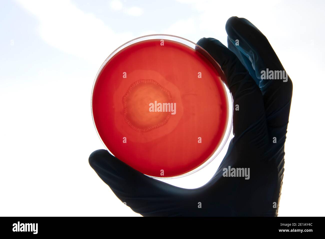 Growing bacteria in agar medium in microbiology lab. Making streak in a ...