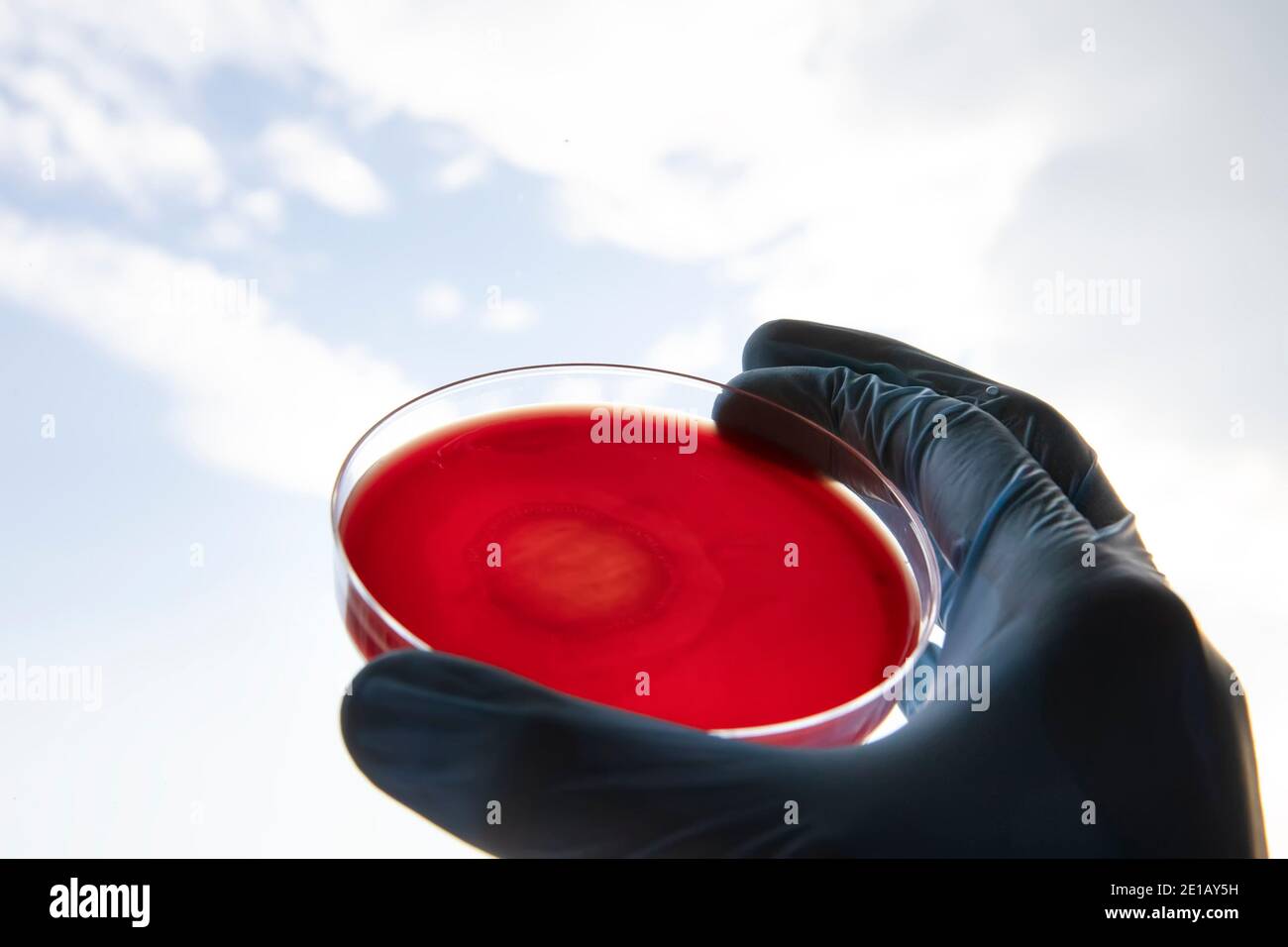 Growing bacteria in agar medium in microbiology lab. Making streak in a ...