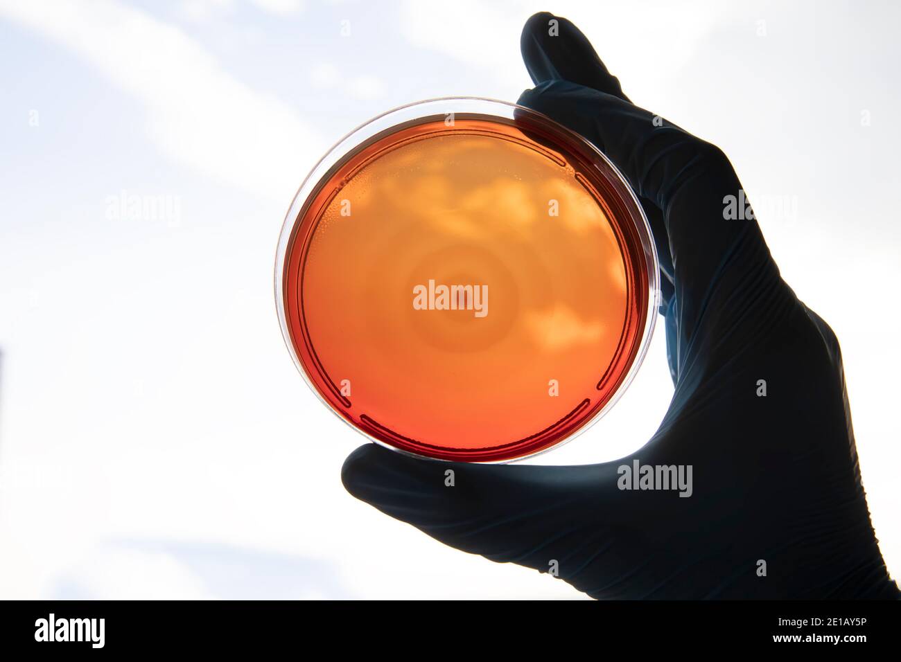 Growing bacteria in agar medium in microbiology lab. Making streak in a ...