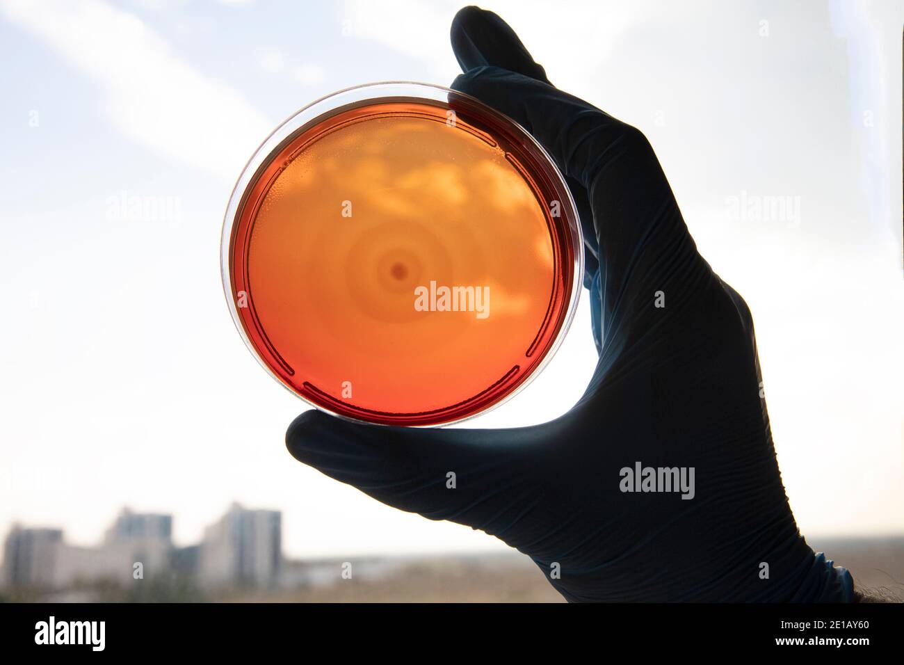 Growing bacteria in agar medium in microbiology lab. Making streak in a ...