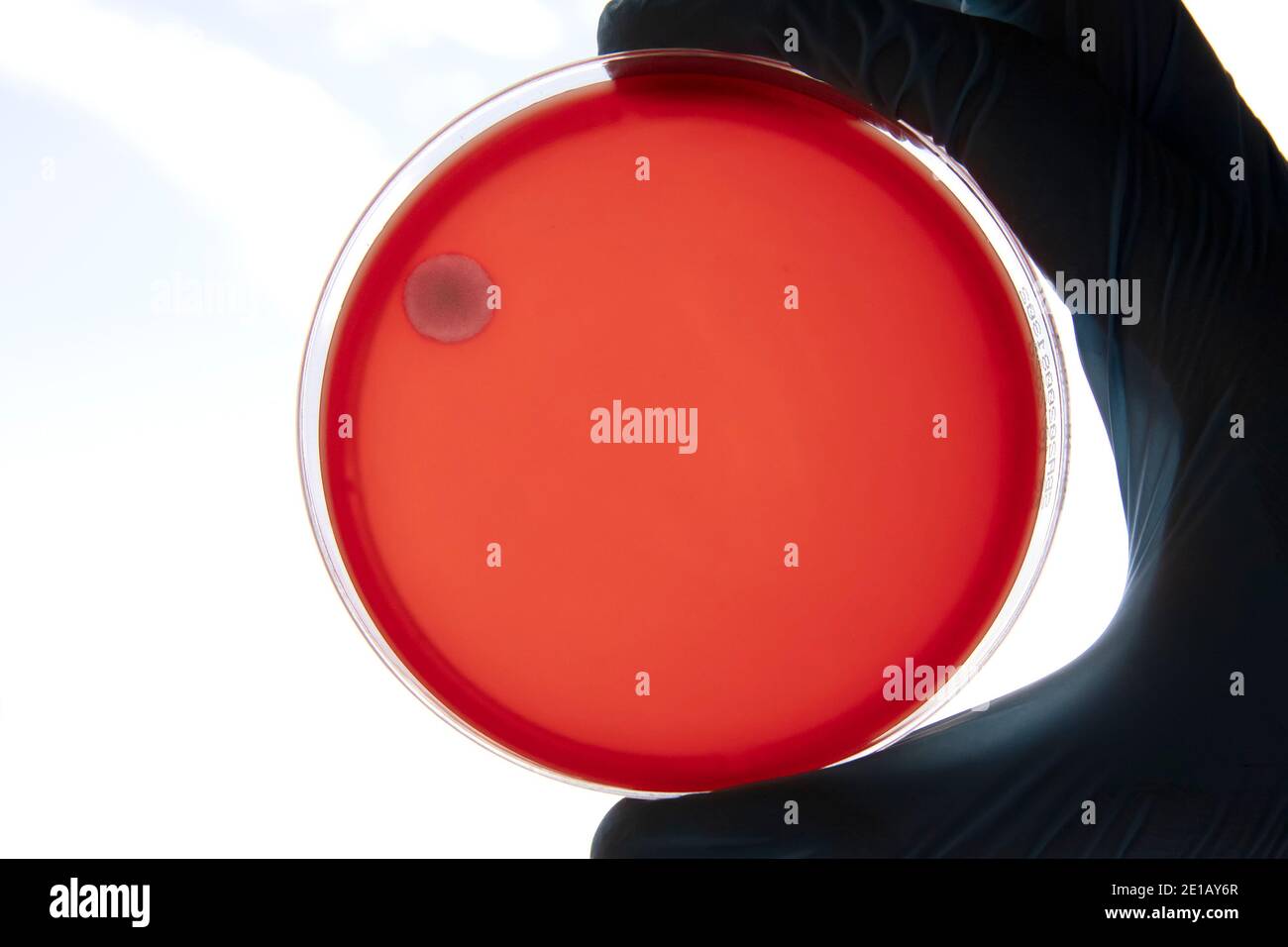 Growing bacteria in agar medium in microbiology lab. Making streak in a ...