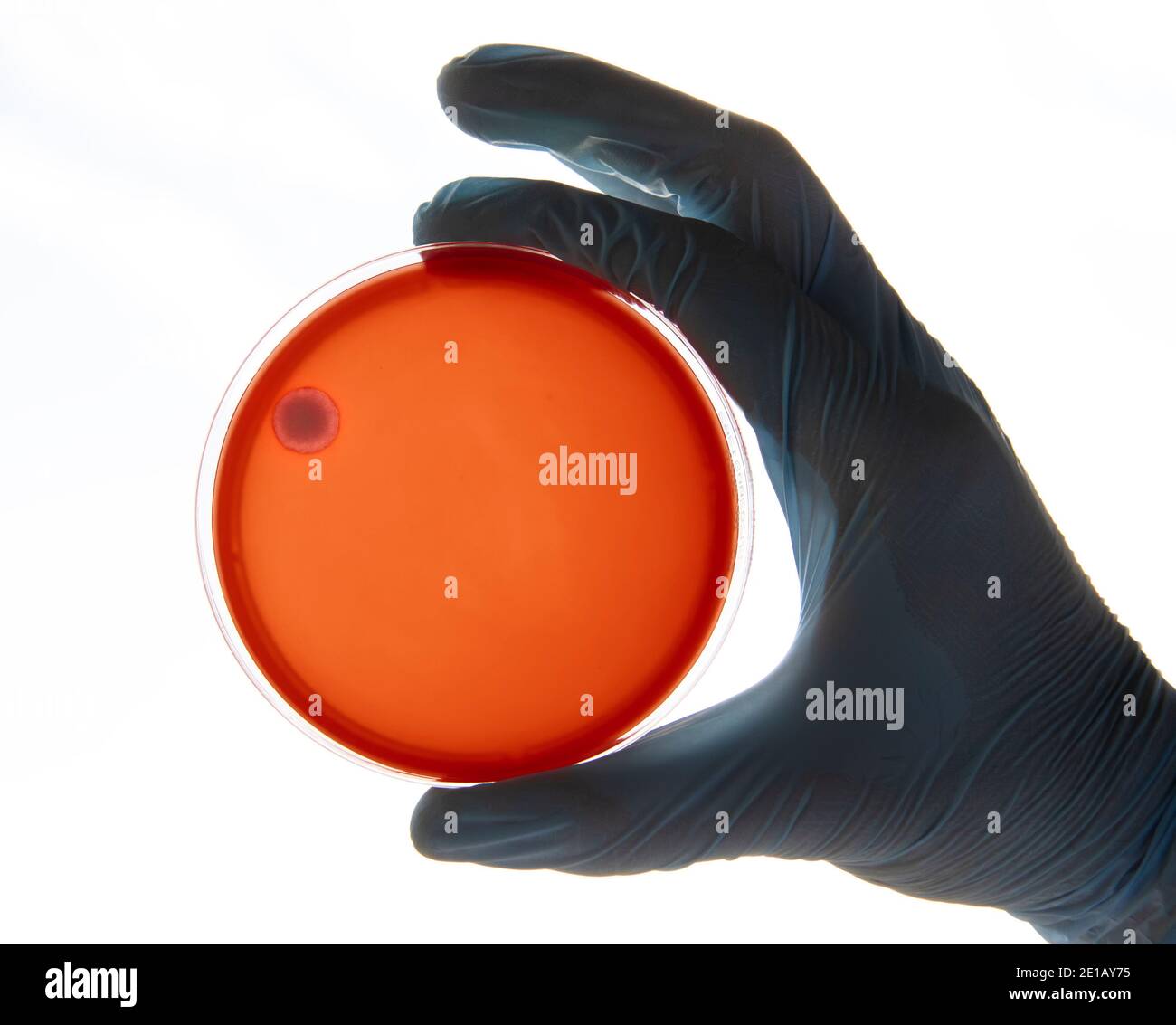 Growing bacteria in agar medium in microbiology lab. Making streak in a ...