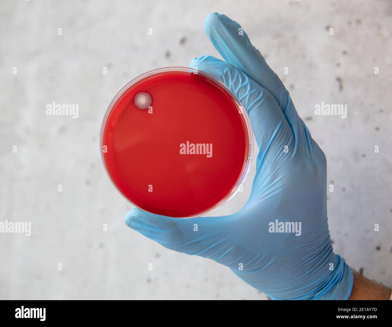 Growing bacteria in agar medium in microbiology lab. Making streak in a ...