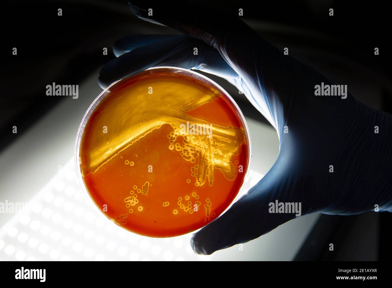Growing bacteria in agar medium in microbiology lab. Making streak in a ...