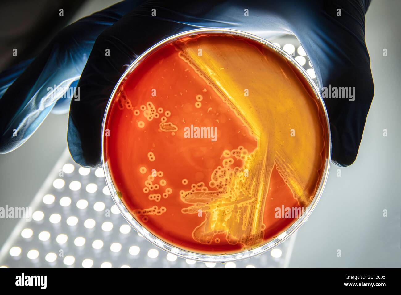 Growing bacteria in agar medium in microbiology lab. Making streak in a ...