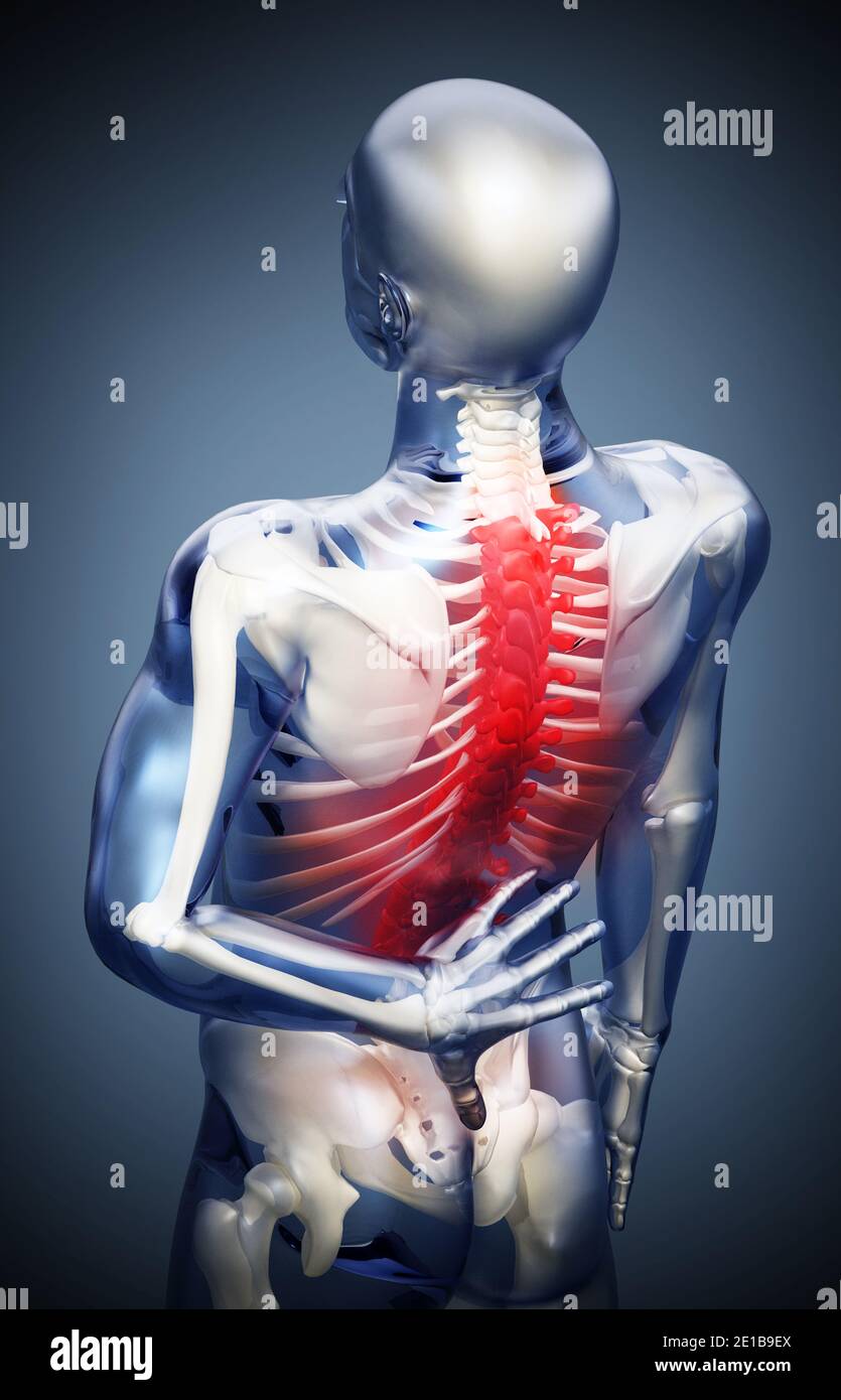 3D illustration showing back pain or pain on the spine Stock Photo - Alamy