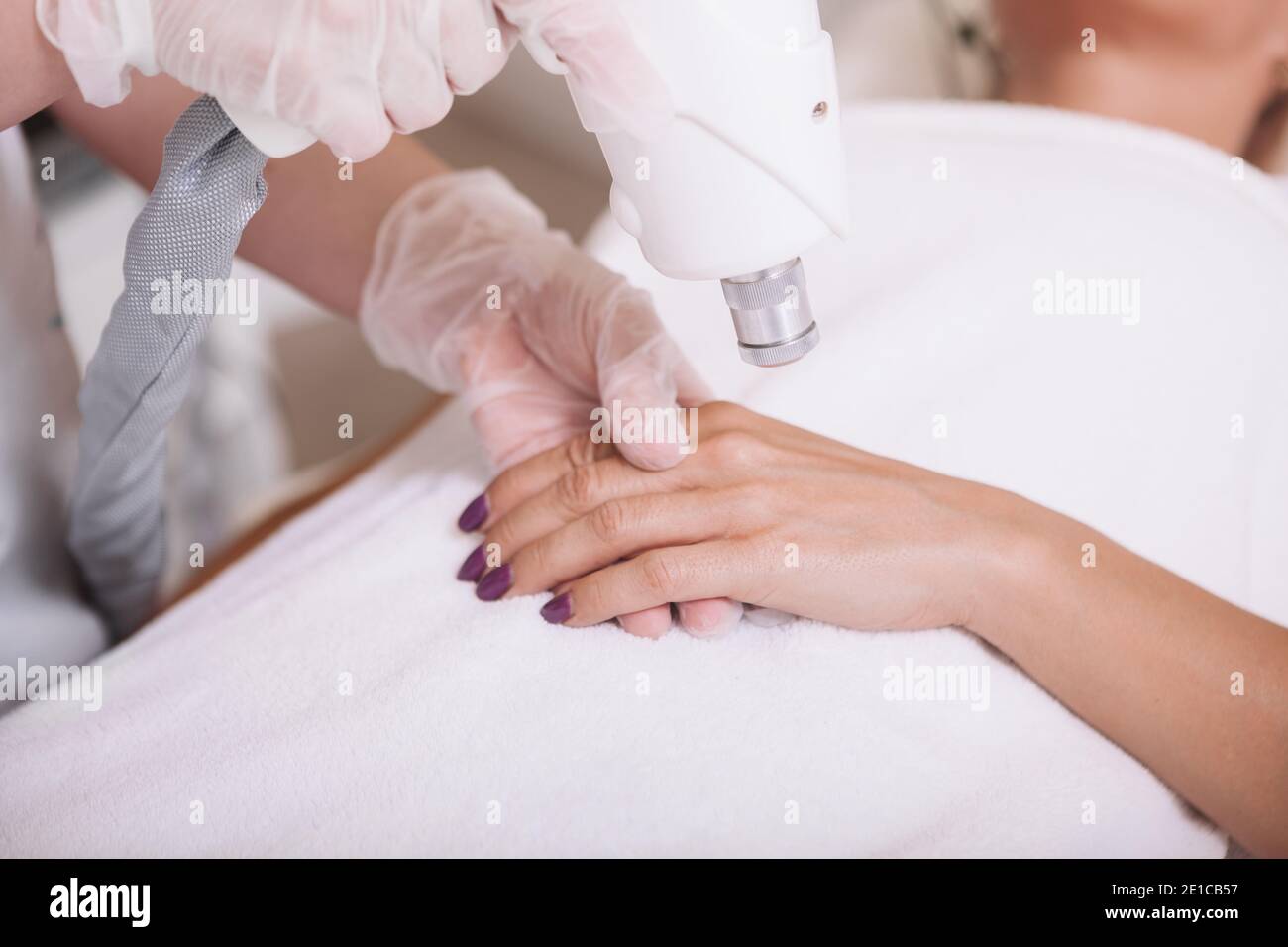 Cropped close up of a mature woman getting skin pigmentation removed on ...