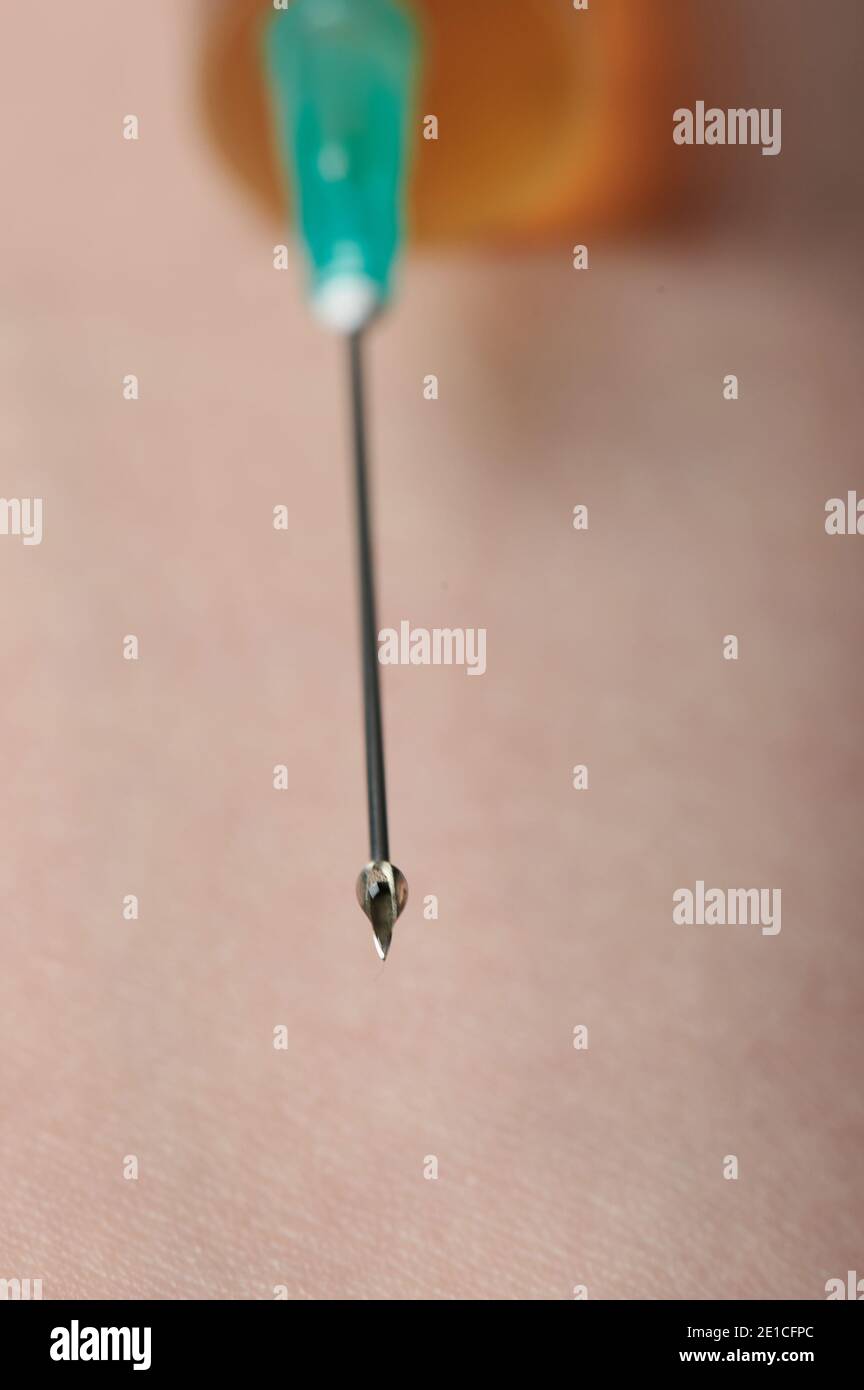 Injection with syringe theme macro close up view in blurred skin ...