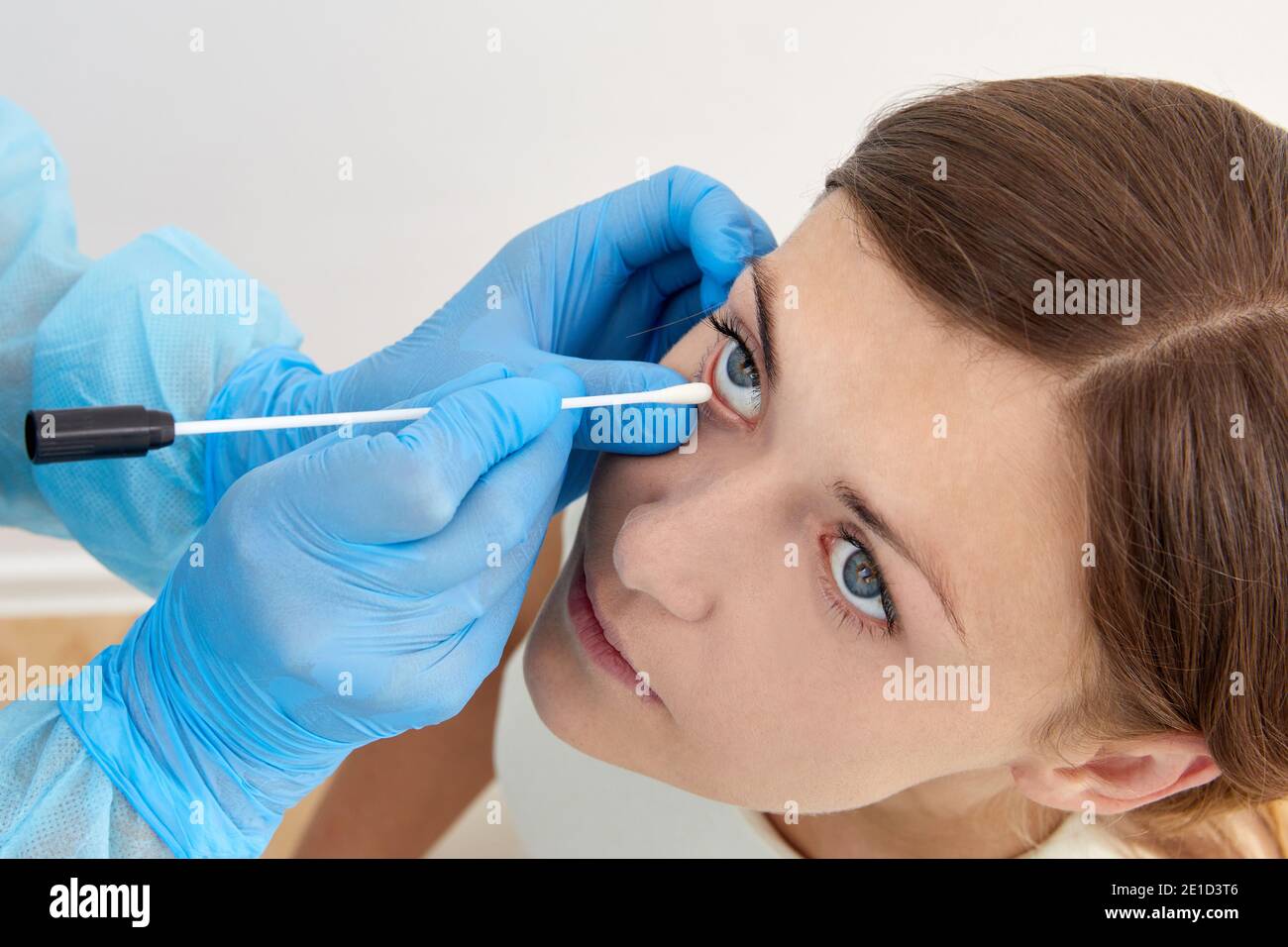 Doctor taking sample with swab from the eye Stock Photo - Alamy