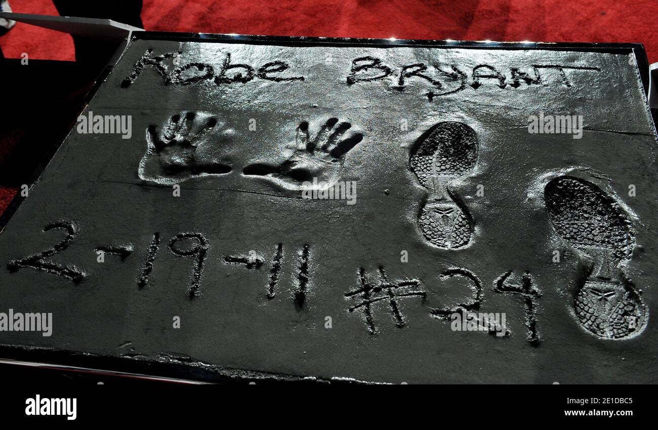 Los Angeles Lakers shooting guard Kobe Bryant attends his hand and ...