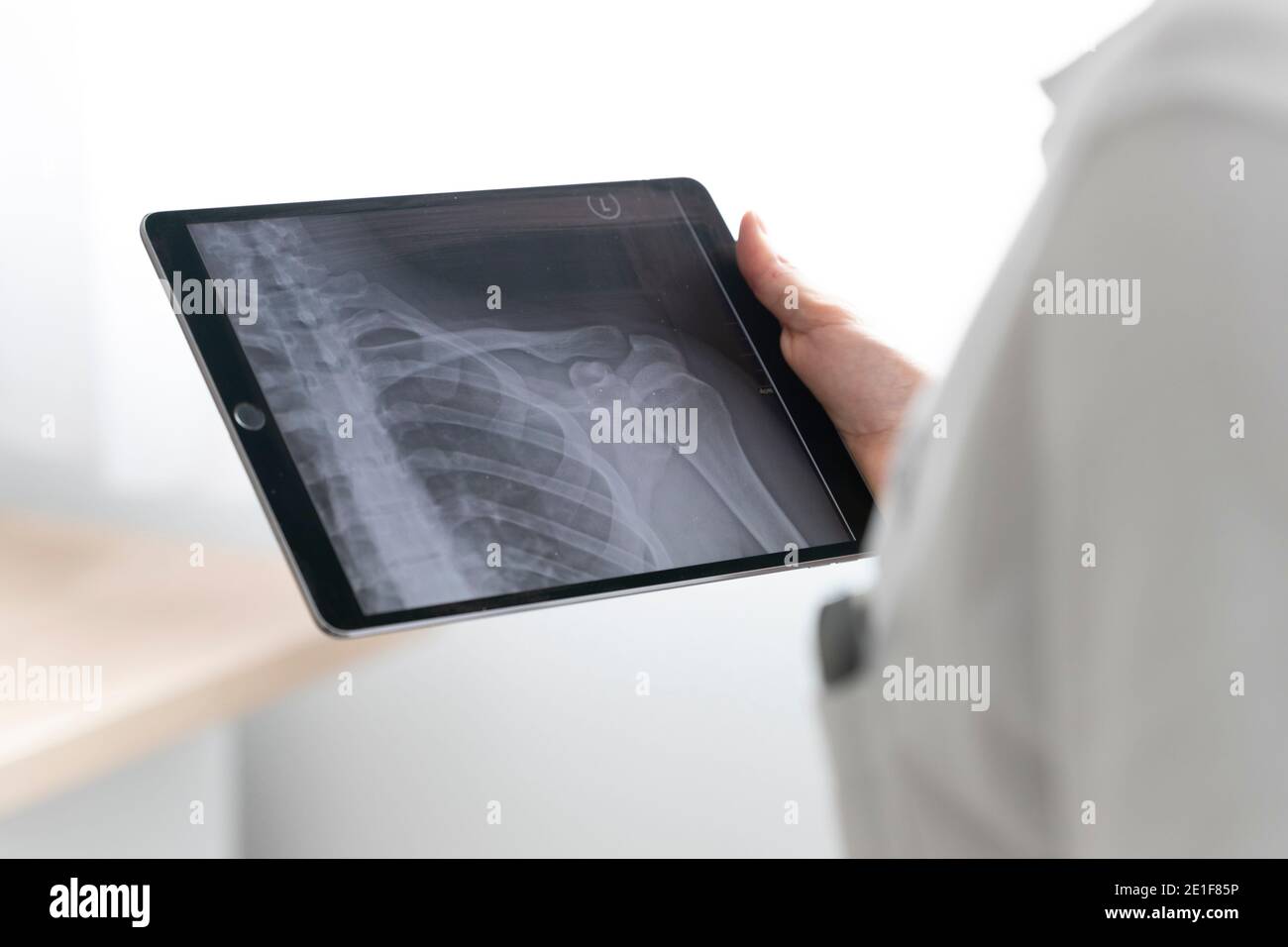 a healthcare professional looks at the x-ray of a shoulder on a tablet ...