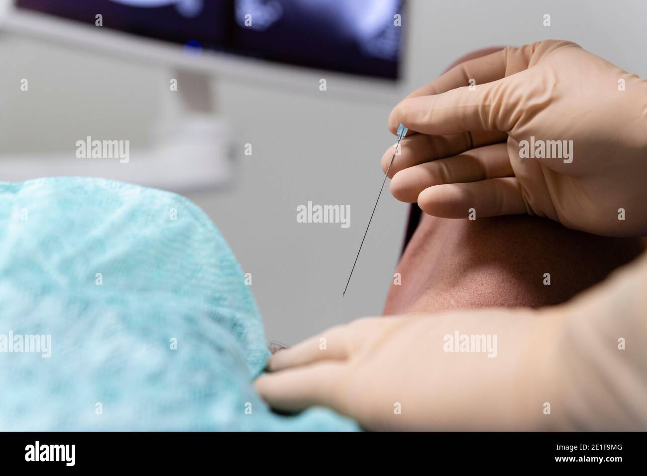 Wrist injection hi-res stock photography and images - Alamy