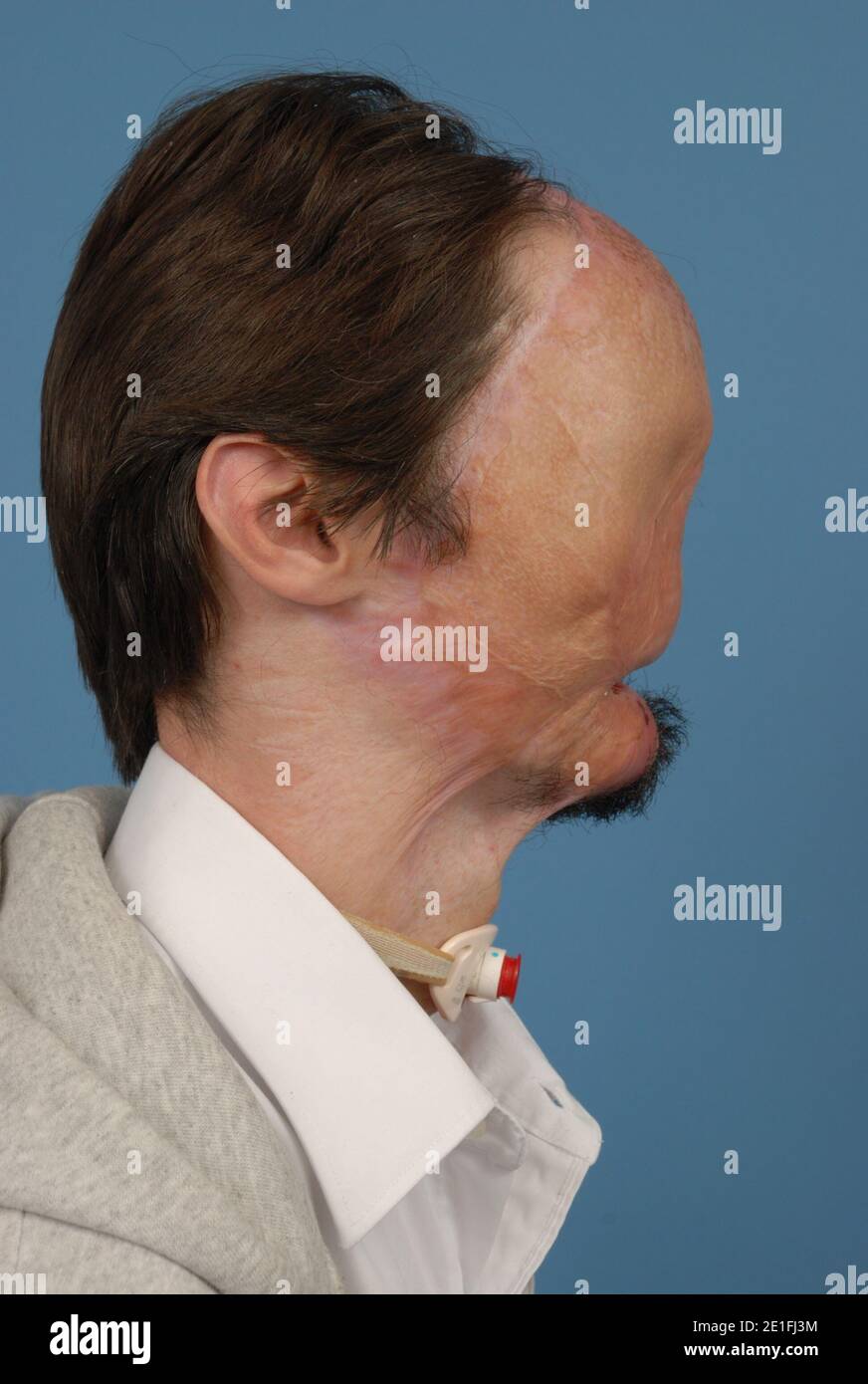 EDITORS PLEASE NOTE EXPLICIT CONTENT. Photos of Dallas Wiens taken in ...