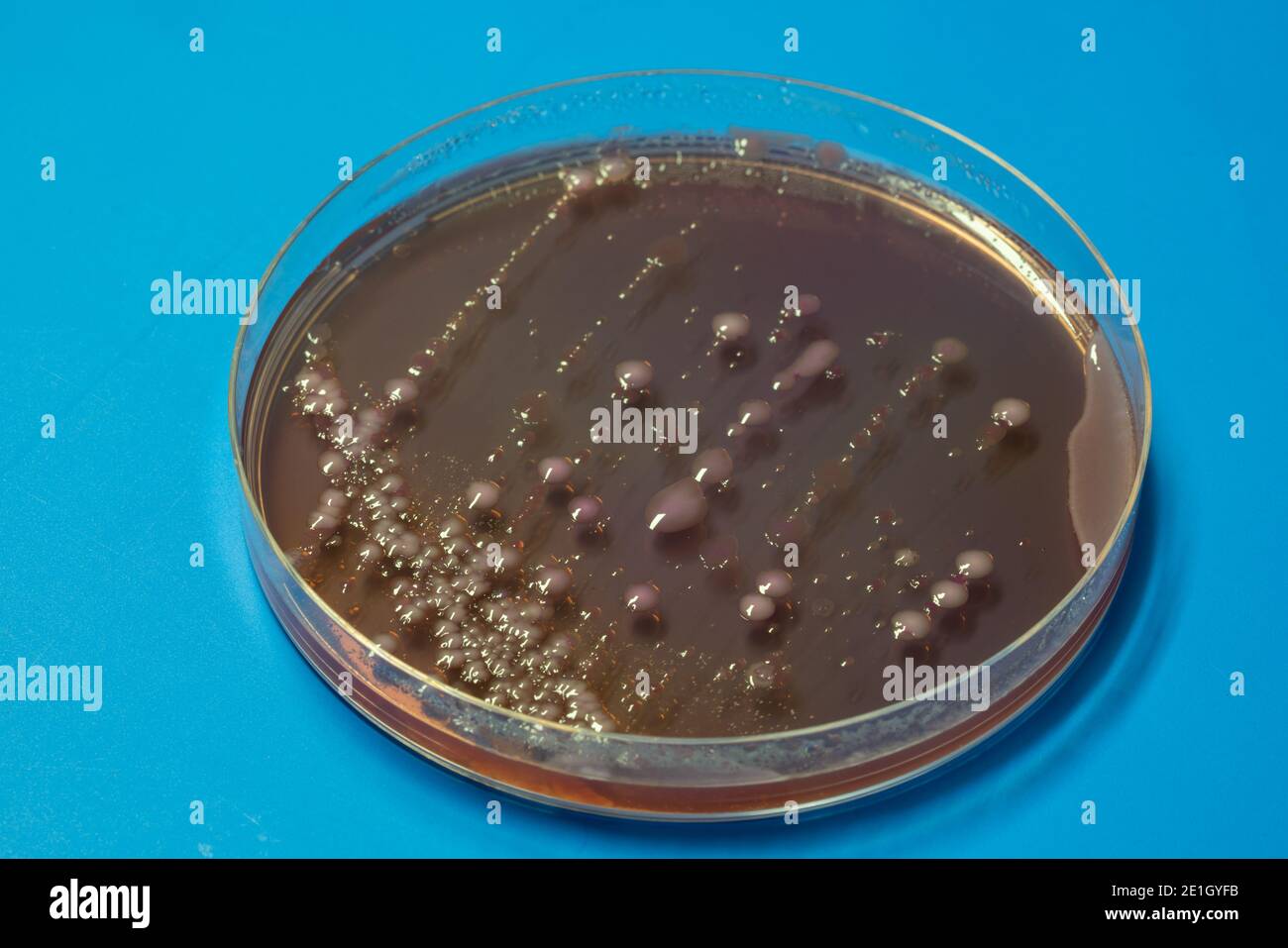 Macconkey agar plate hi-res stock photography and images - Alamy