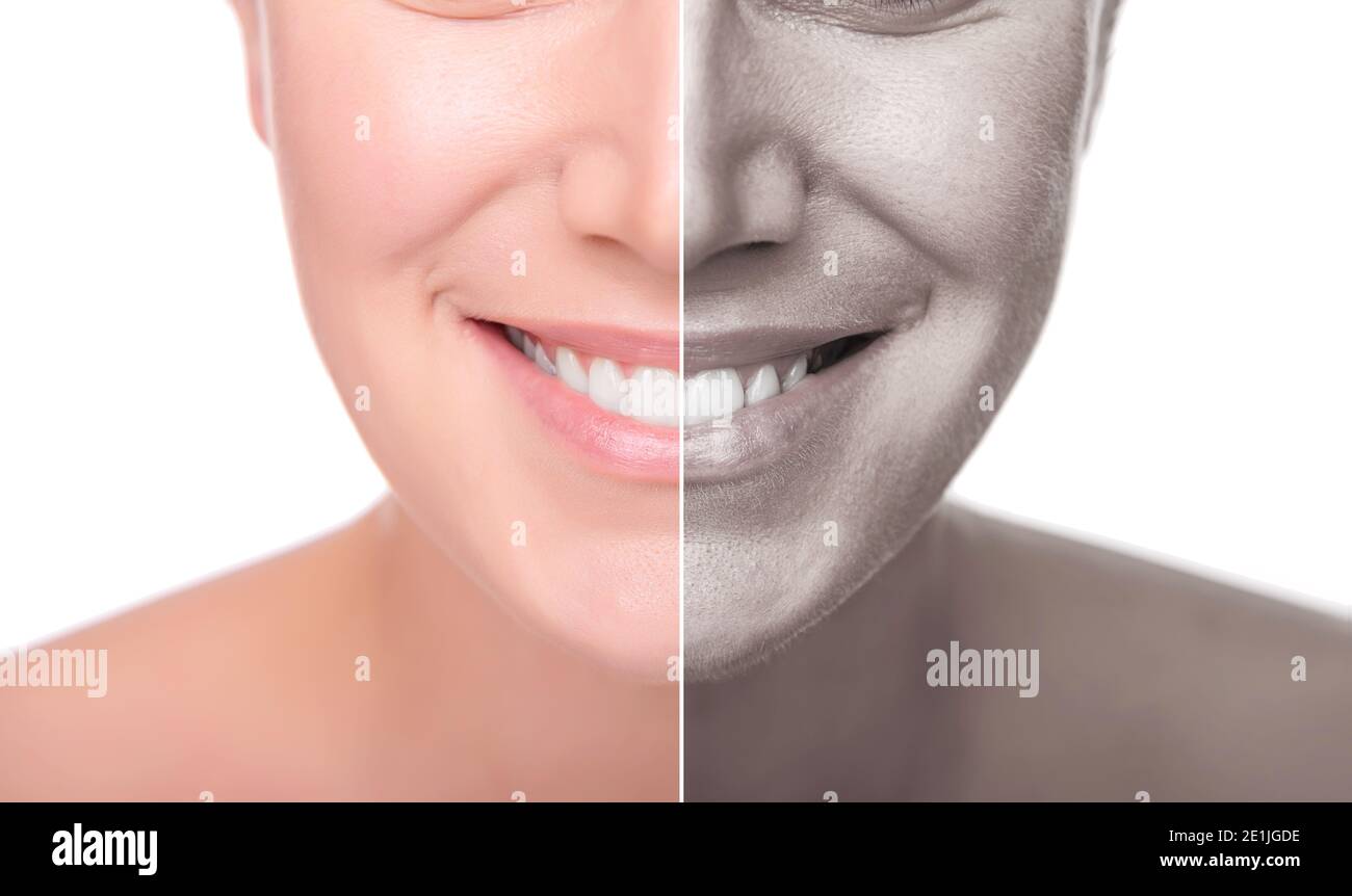A woman's face is split in half for good and bad skin. Isolated on ...