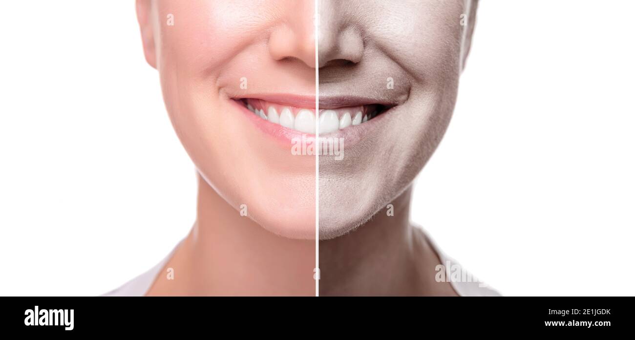 A woman's face is split in half for good and bad skin. Isolated on ...