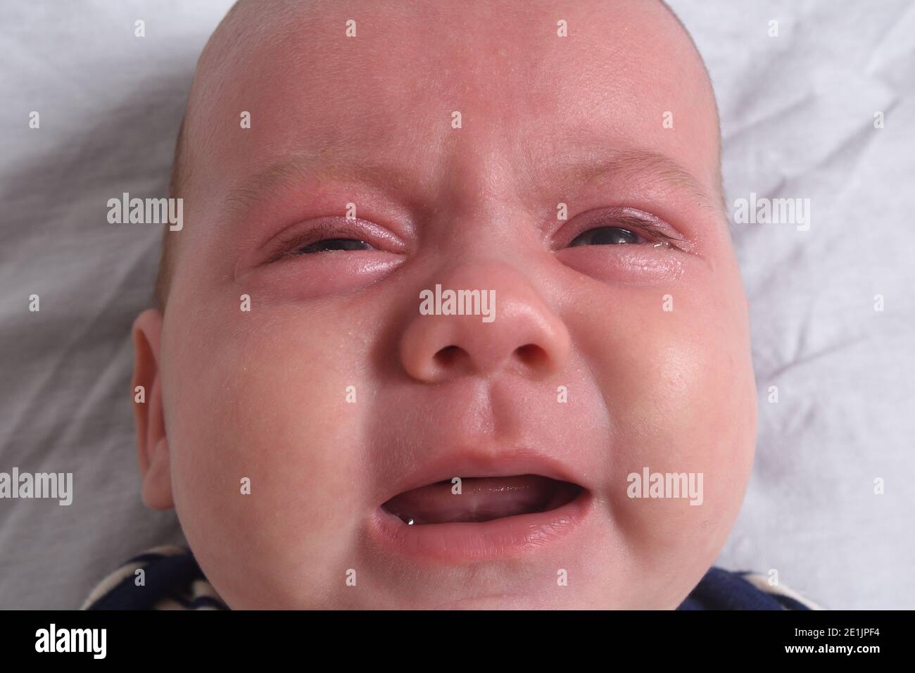 Reddish skin hi-res stock photography and images - Alamy