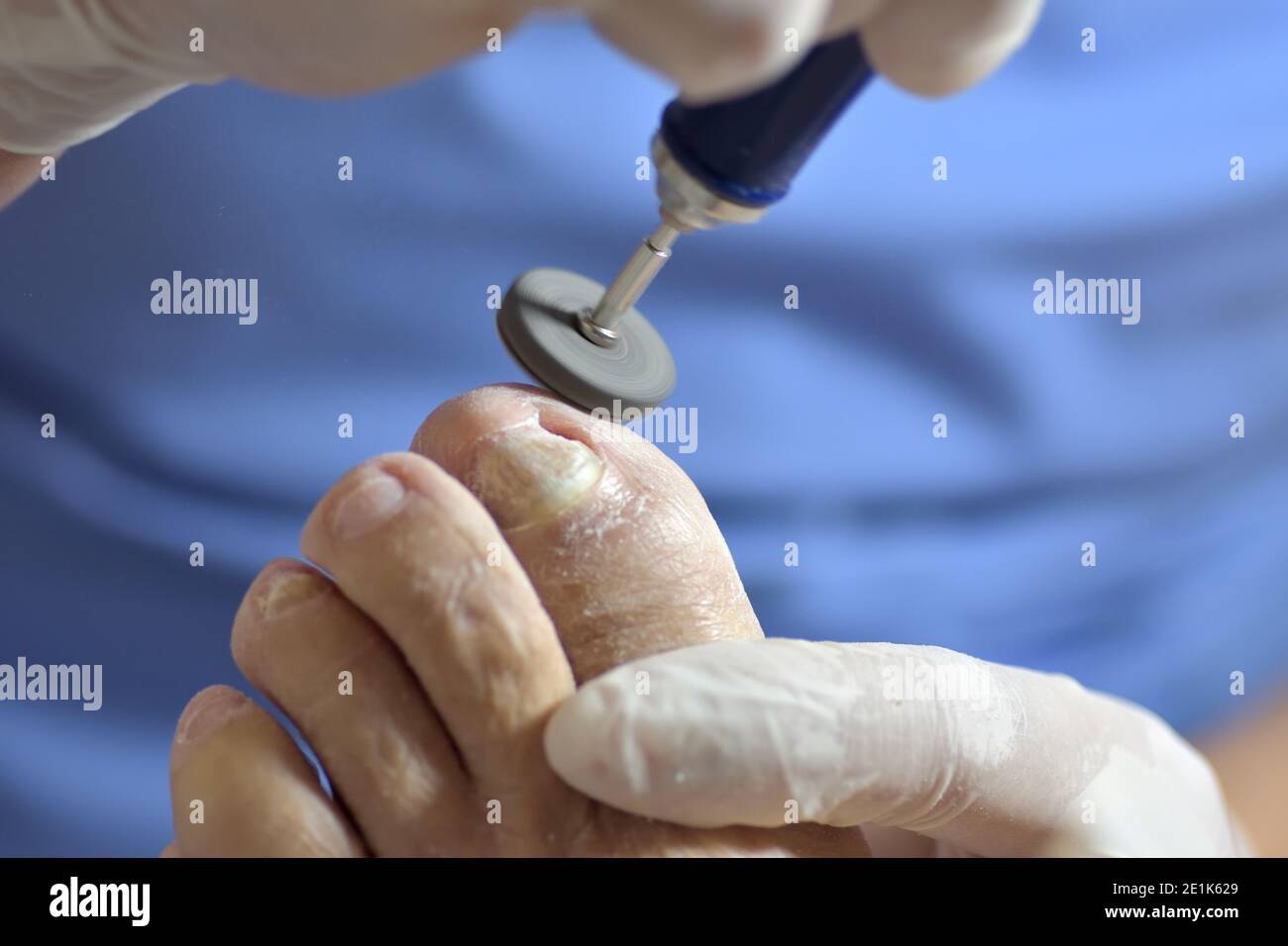 Podiatry Lathe High Resolution Stock Photography and Images - Alamy