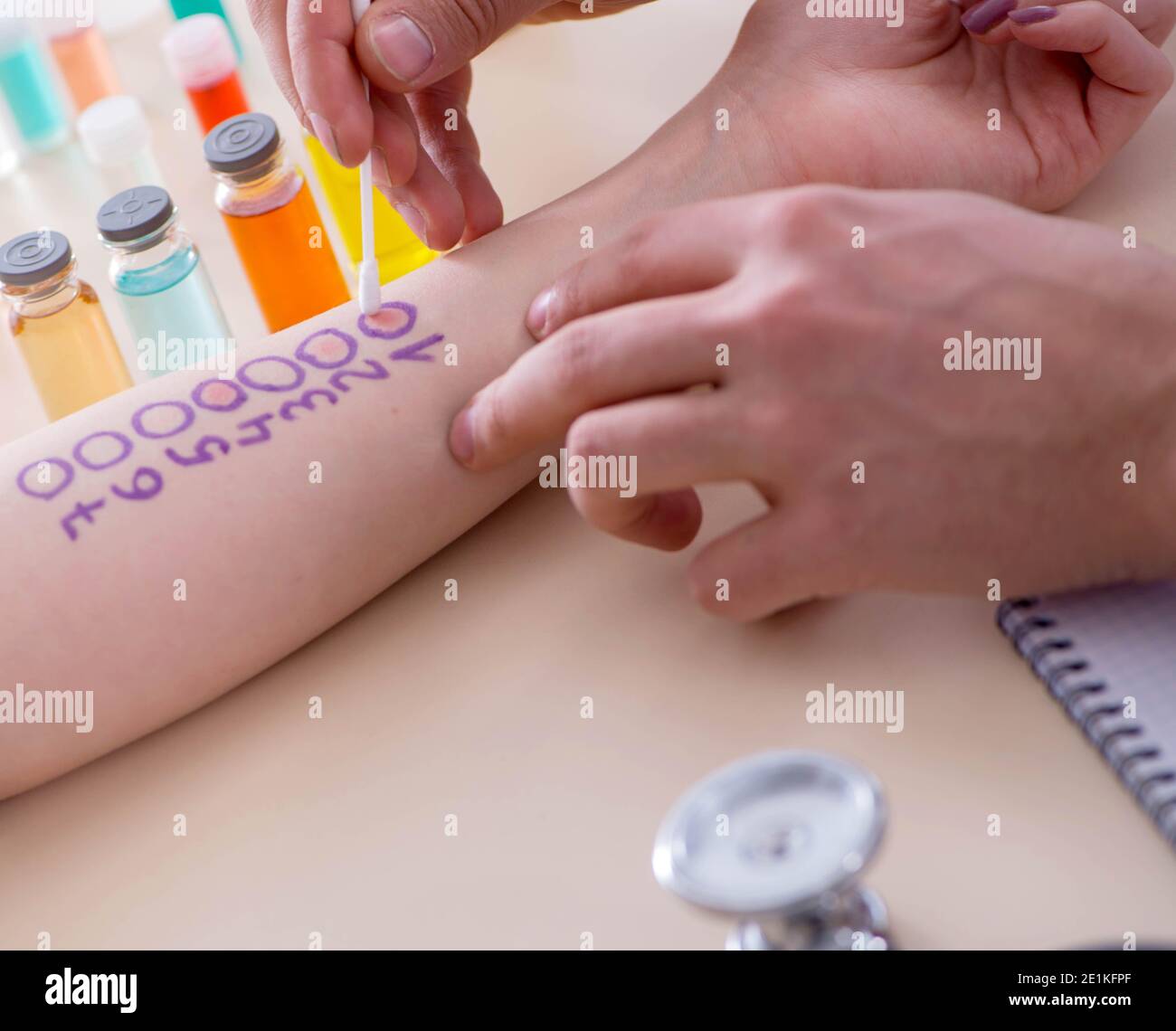 The doctor testing allergy reaction of patient in hospital Stock Photo ...