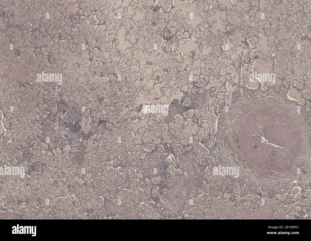 cross section cut of human body cells under a scientific microscope ...