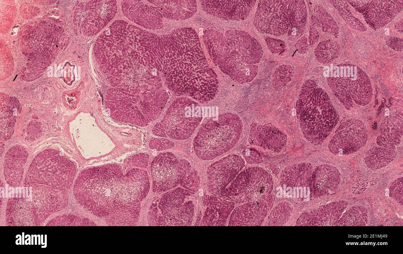 cross section cut of human body cells under a scientific microscope ...