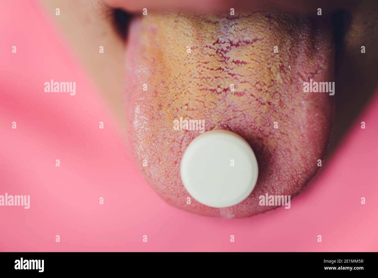 Lsd Tongue High Resolution Stock Photography and Images - Alamy