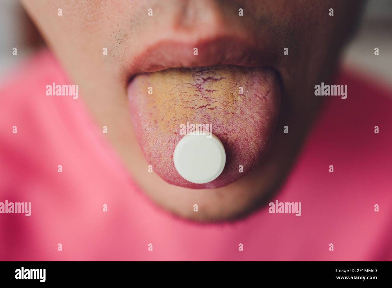 Lsd Tongue High Resolution Stock Photography and Images - Alamy
