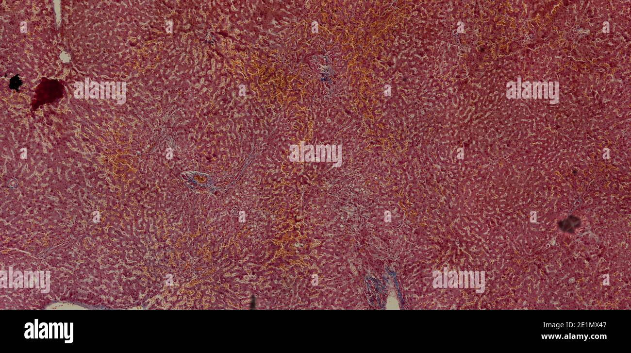 cross section cut of human body cells under a scientific microscope ...